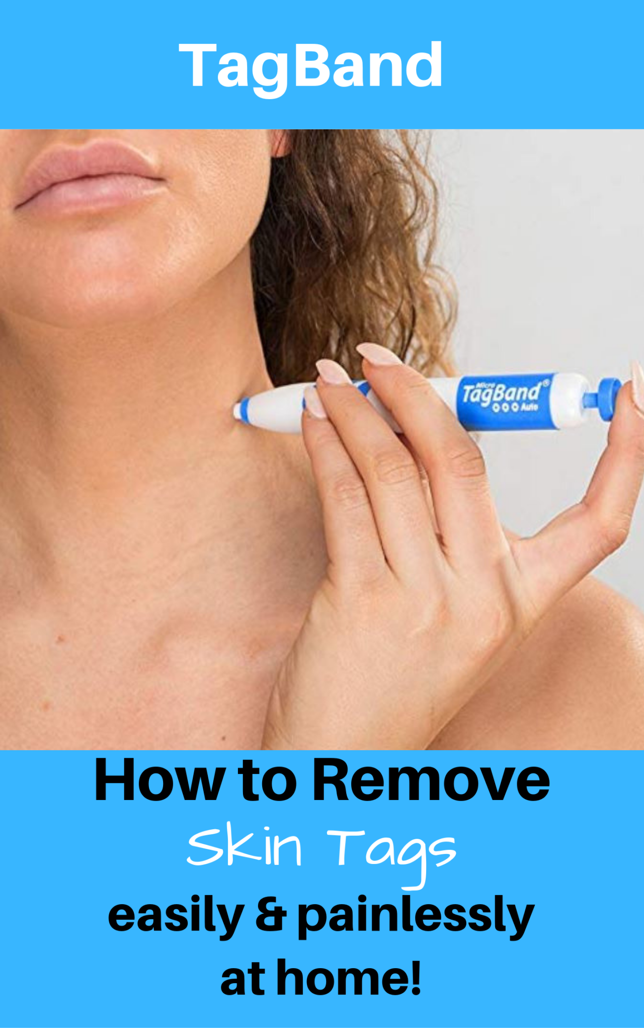 TagBand-Skin Tag Removal Review – its-obvious